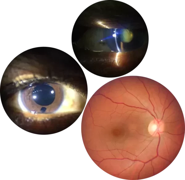 Emergency Department Bedside Eye Triage - Remidio