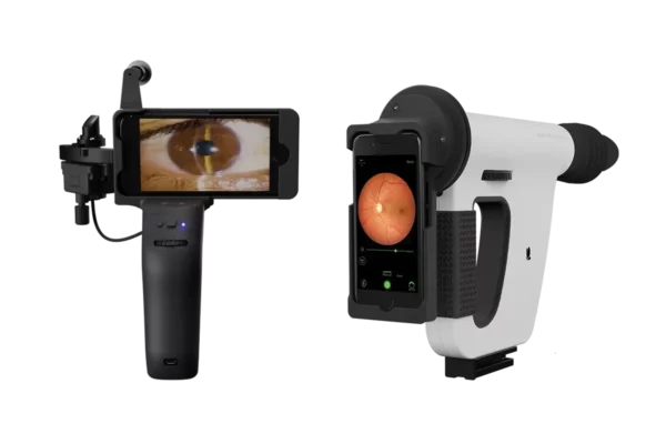 Emergency Department Bedside Eye Triage - Remidio