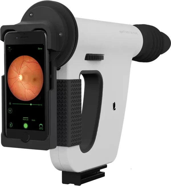 Smarter, Portable Diabetic Retinopathy Screening - Remidio