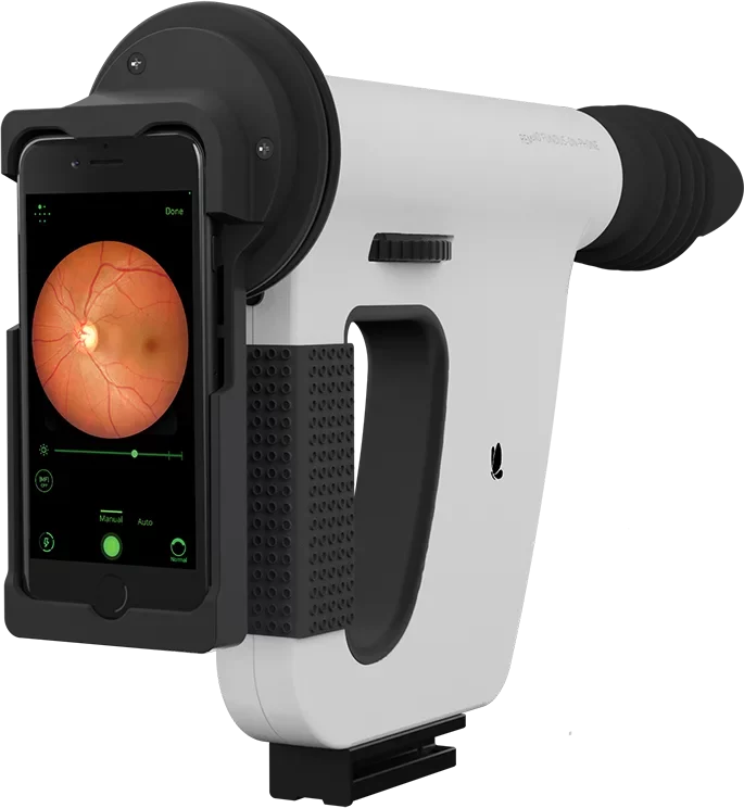 Portable Handheld Non-Mydriatic Fundus Camera | Remidio FOP-NM - Remidio